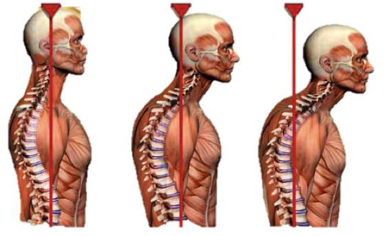 TIP13: Good Posture. - Realign First